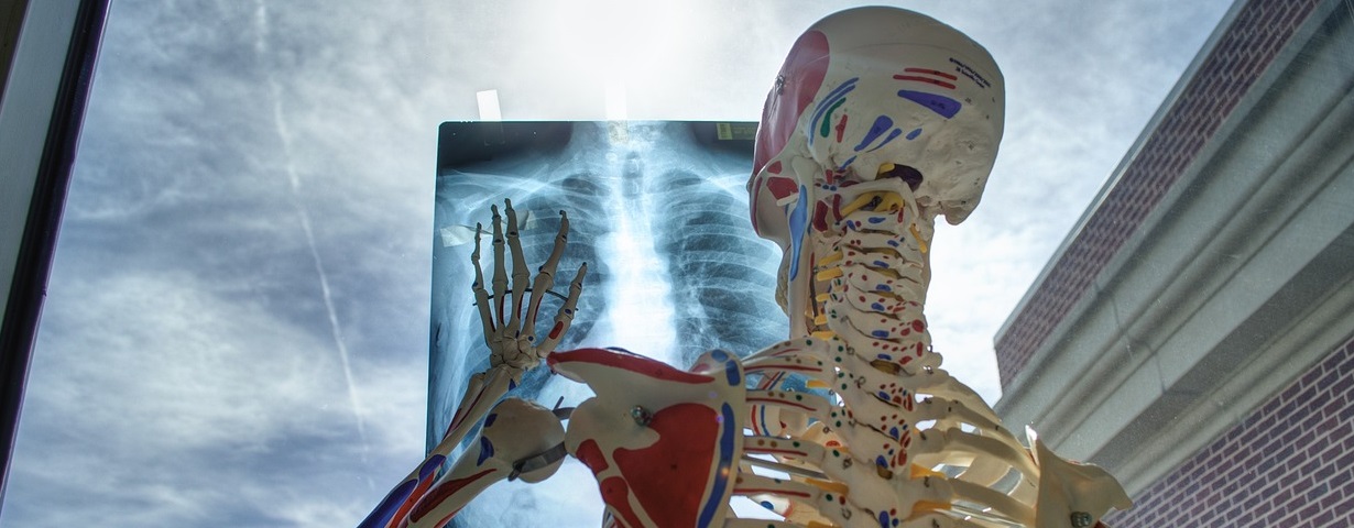Rayos X: Explicación para niños - ¡A aprender!